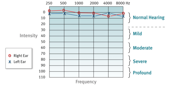 Understanding How We Hear: From Sound Waves to the Brain